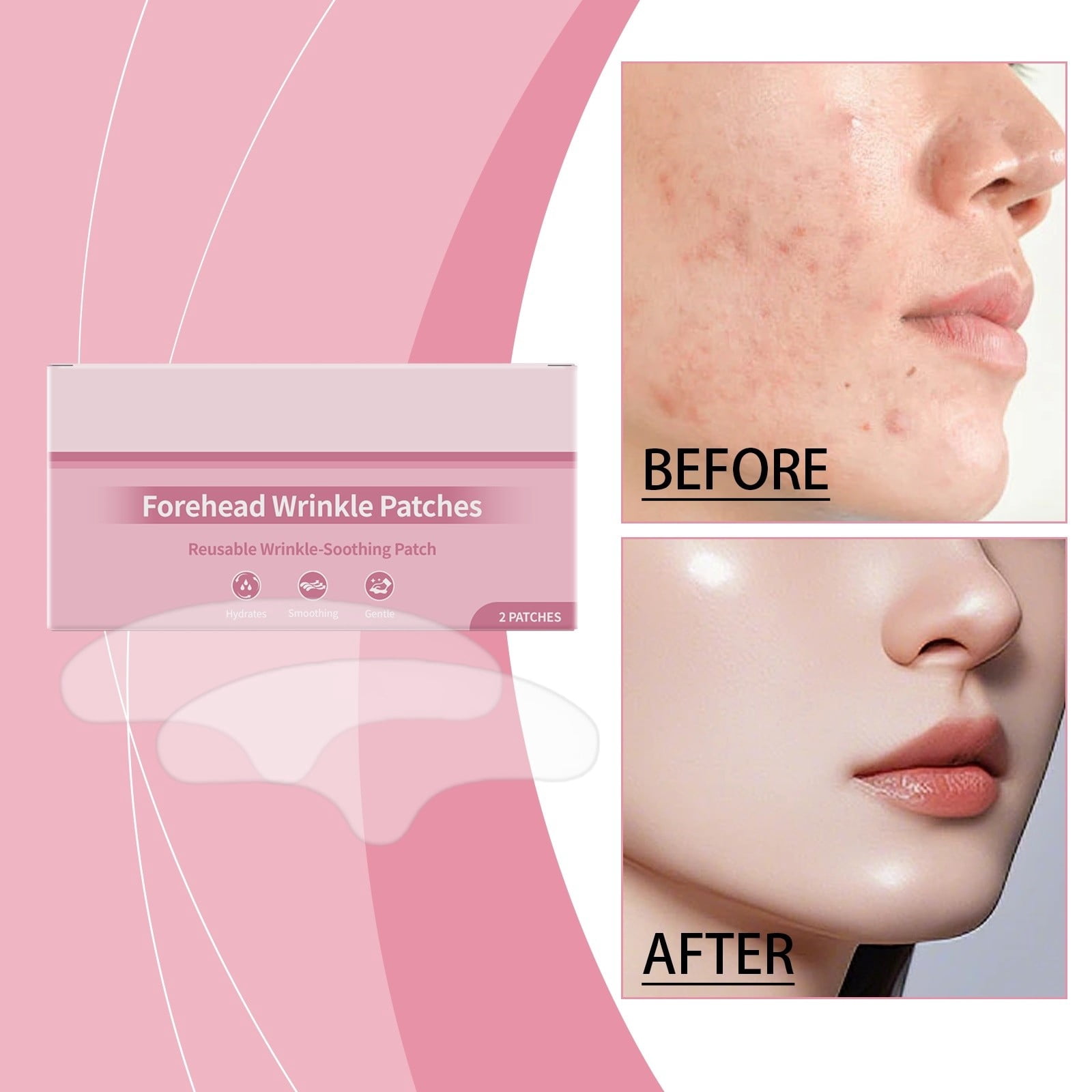 Forehead Lifting and Firming Patch Reduces Wrinkles and Forehead Lines ...