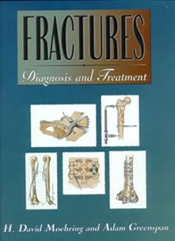 Fractures: Diagnosis and Treatment - Walmart.com