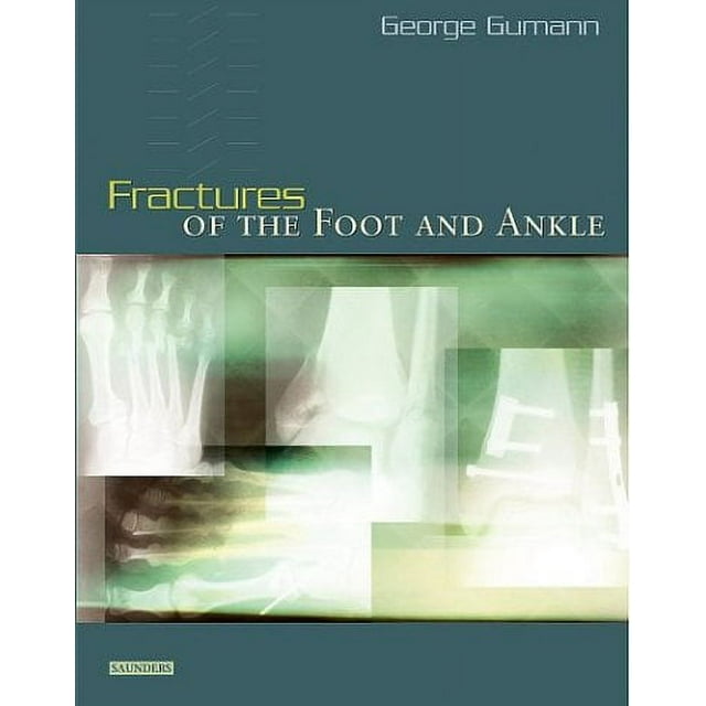 Fractures of the Foot and Ankle - George Gumann - Walmart.com