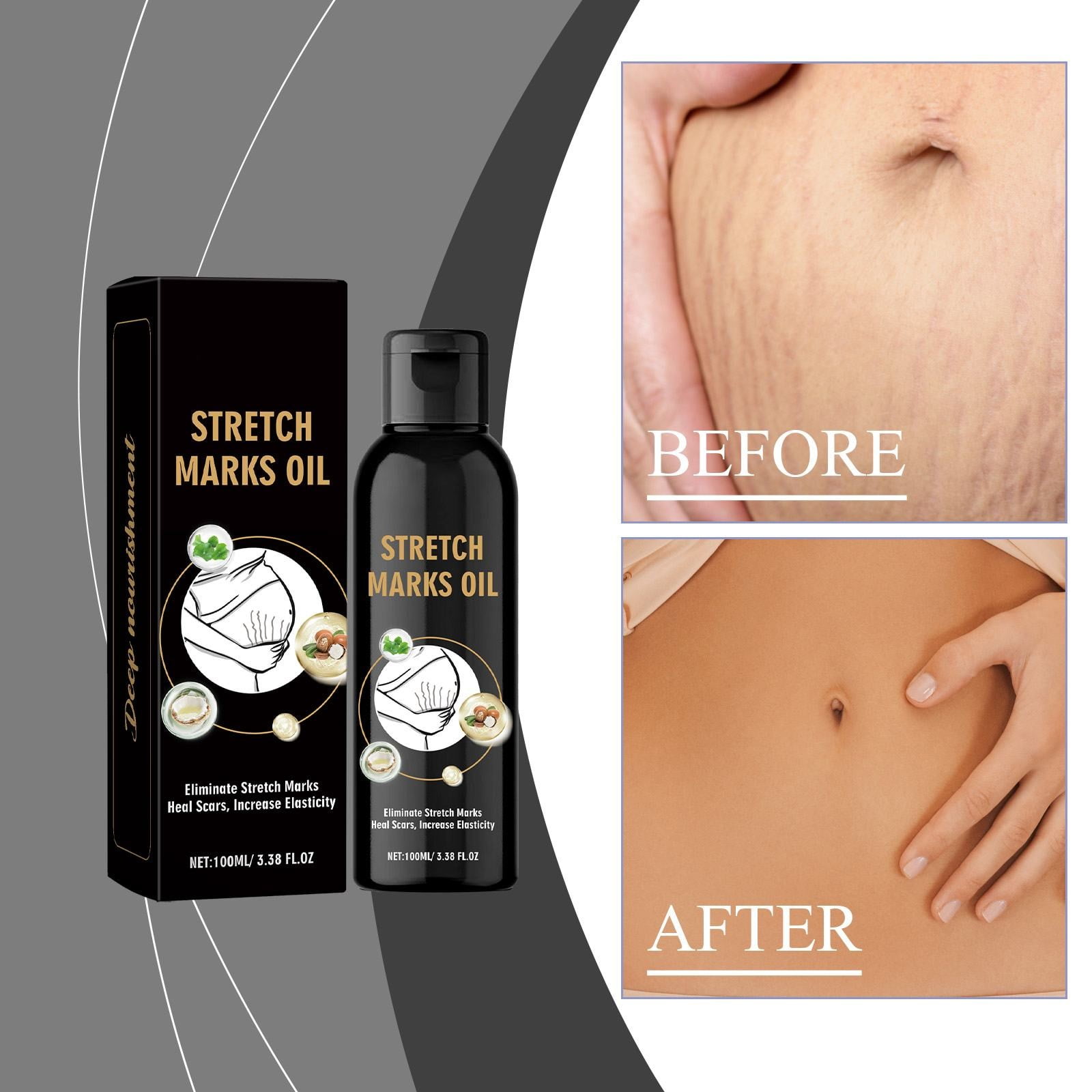 Fragrance,Prophylaxis Stretch Marks During Pregnancy With Care Oil That ...