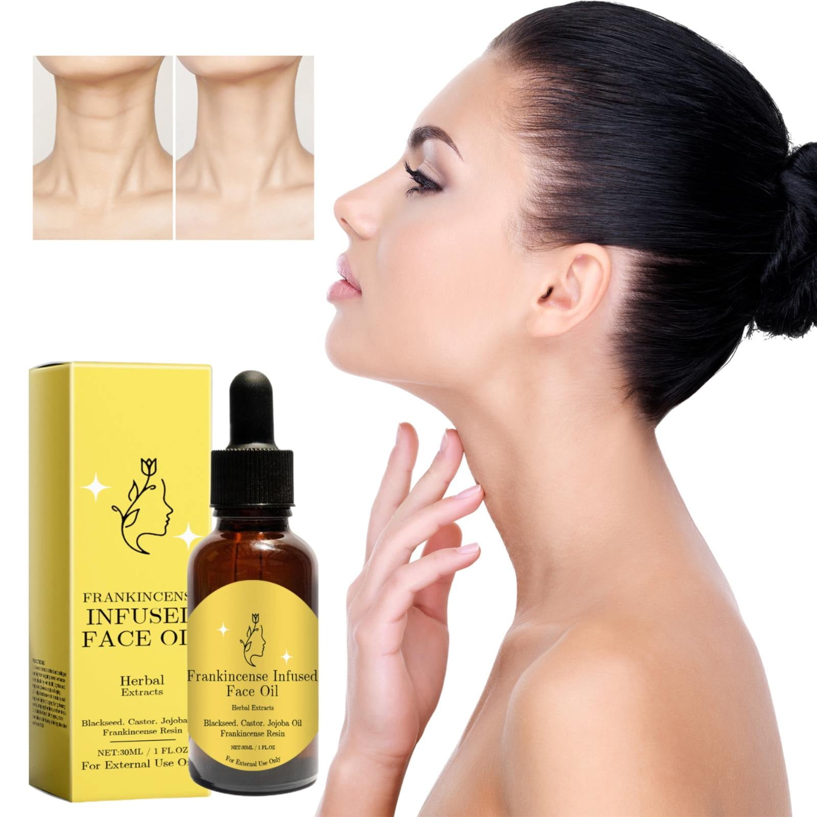 Frankincense Resin Infused Organic Black Seed Jojoba Oils for Facial ...