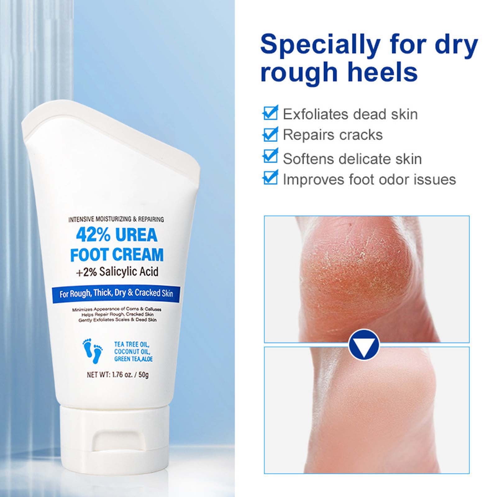 Summer Savings Clearance! Urea Cream Foot Protection Cream 50g ...