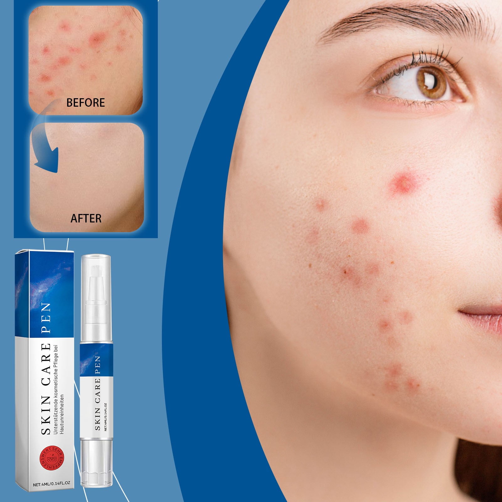 Fresh Wolf Facial Cleansing Wipes Pimple Skin ning Needless Pore ucing ...