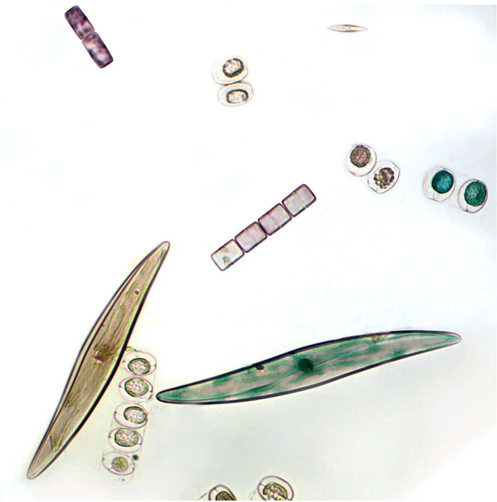 Diatoms Slide Labeled