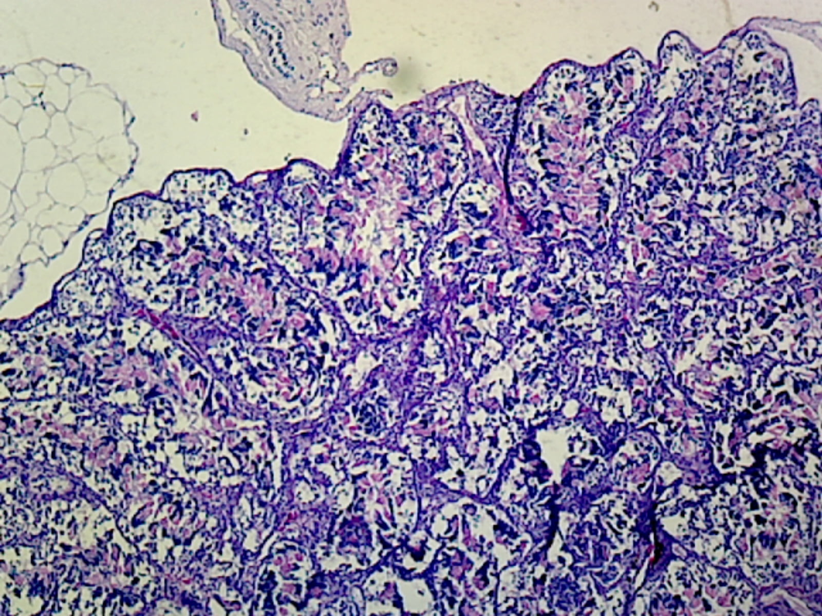 Frog Testis; Section; IH Stain by Go Science Crazy - Walmart.com