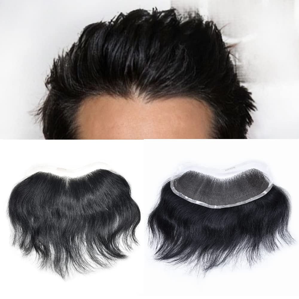 Frontal Wig Hair System for Men Human Hair Piece Replacement Hairline ...