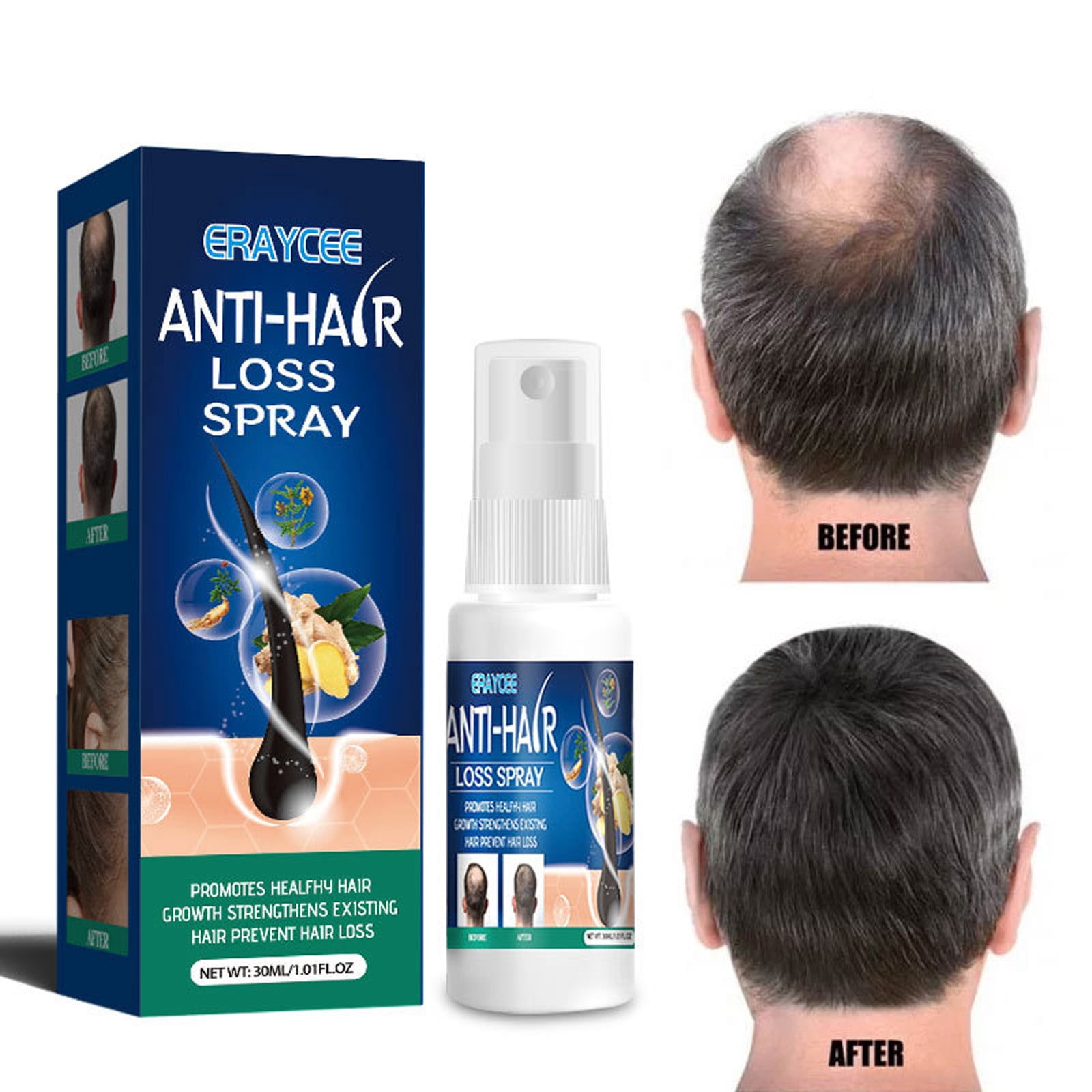 Fufafayo Clearance Hair Growth Products Biotin Fast Growing Hair ...
