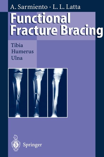 Functional Fracture Bracing: Tibia, Humerus, and Ulna, (Hardcover ...