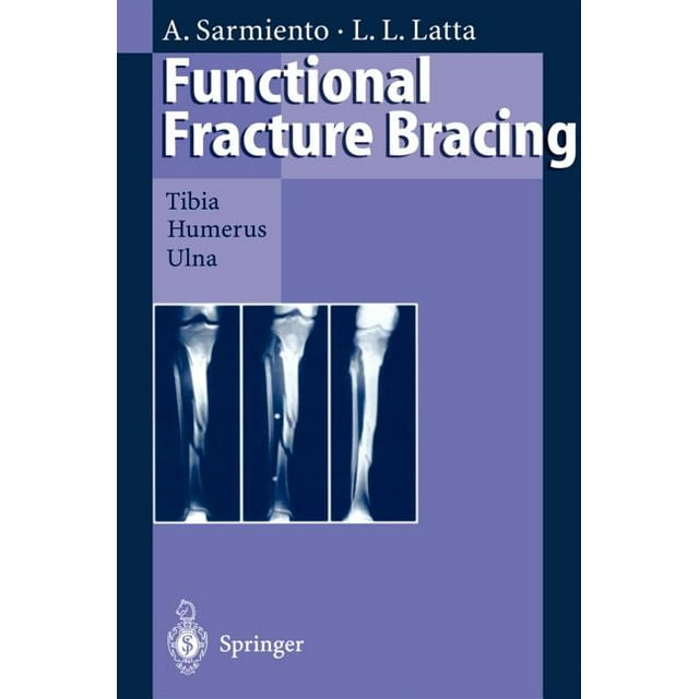 Functional Fracture Bracing: Tibia, Humerus, and Ulna (Hardcover ...