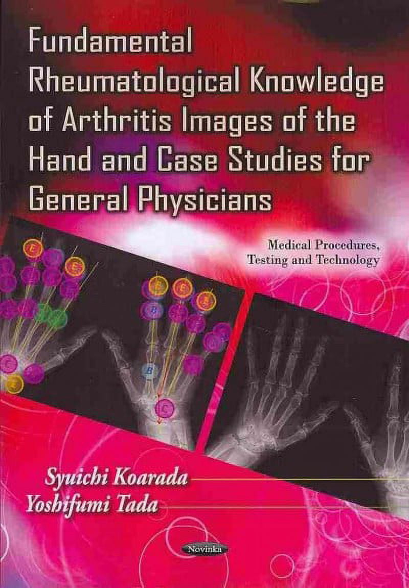 Fundamental Rheumatological Knowledge of Arthritis Images of the Hand ...