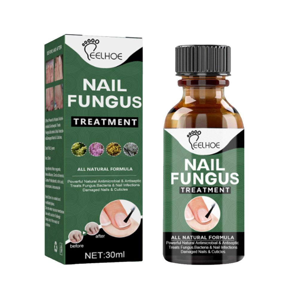 Fungal Nail Repair Essence Care Treatment Whitening 30ml Gel Nail Foot ...
