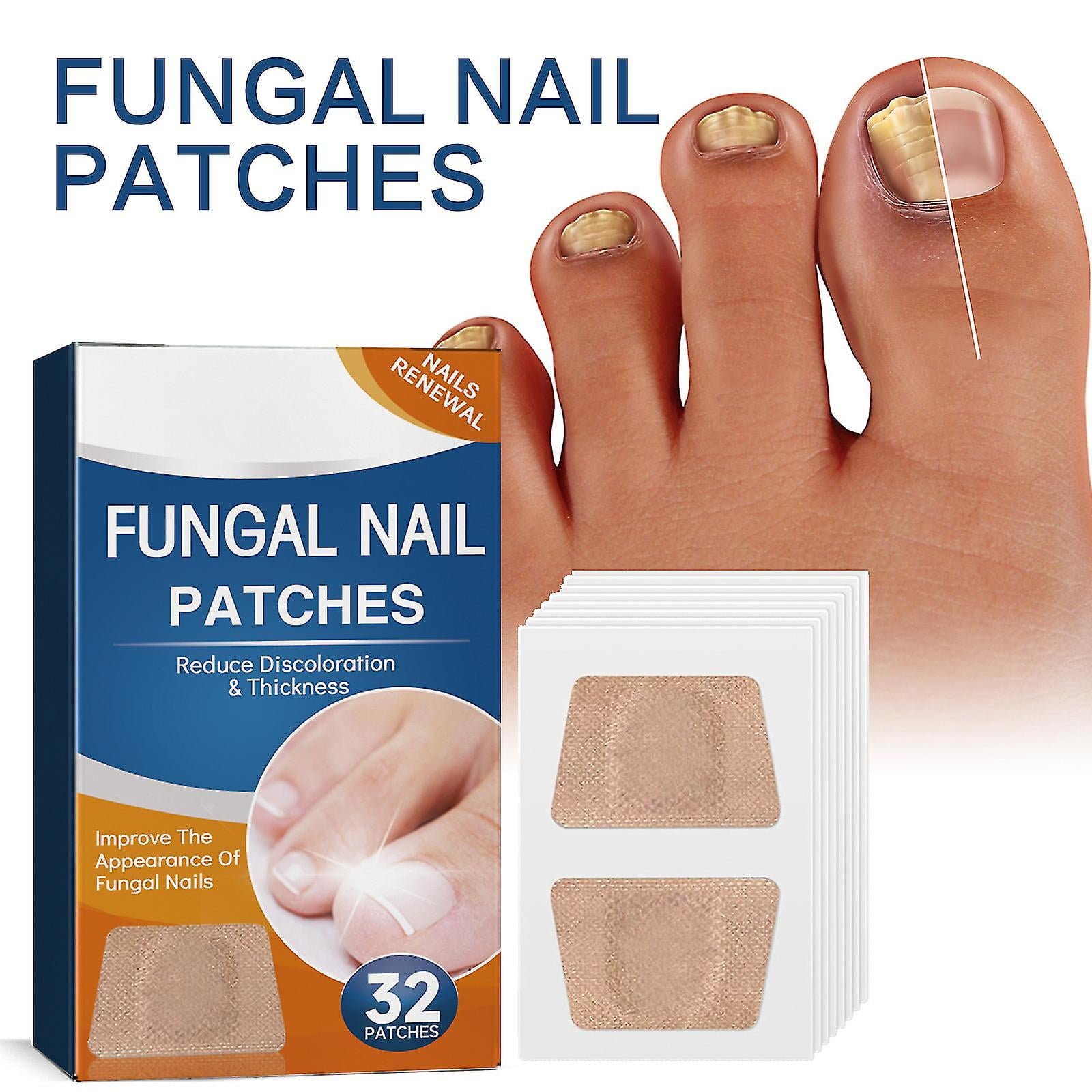 Fungal Nail Repair Patch - Onychomycosis Treatment For Healthy Nails ...
