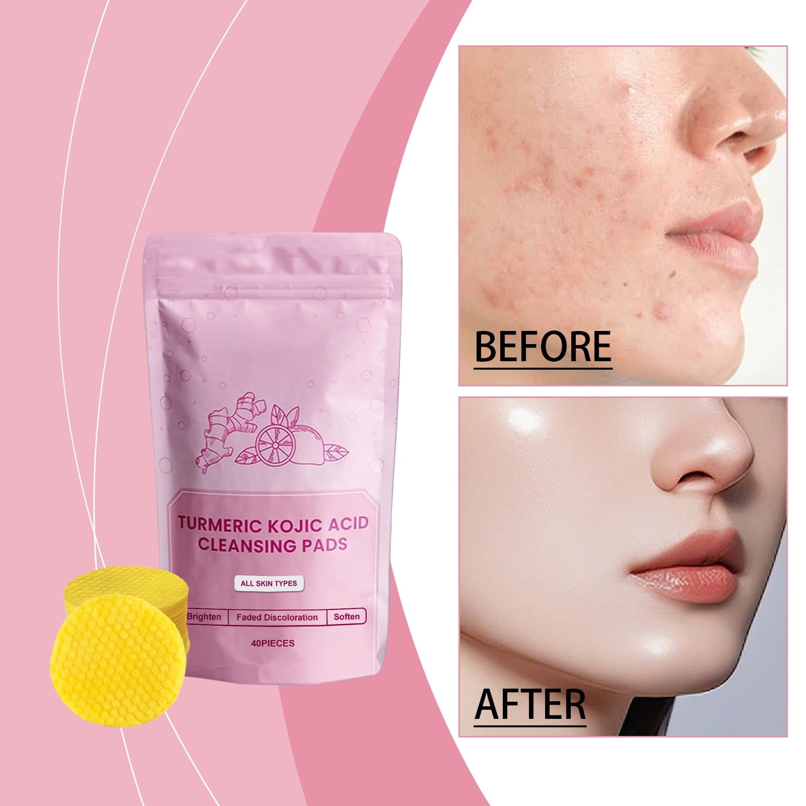 GARENAS Cleansing Pad to Improve Dark Face Skin Deep Clean Soothing and ...