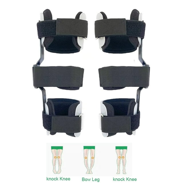 GHORTHOUD Kids Knock Knee Brace Children Bow Leg Correct OX Leg ...