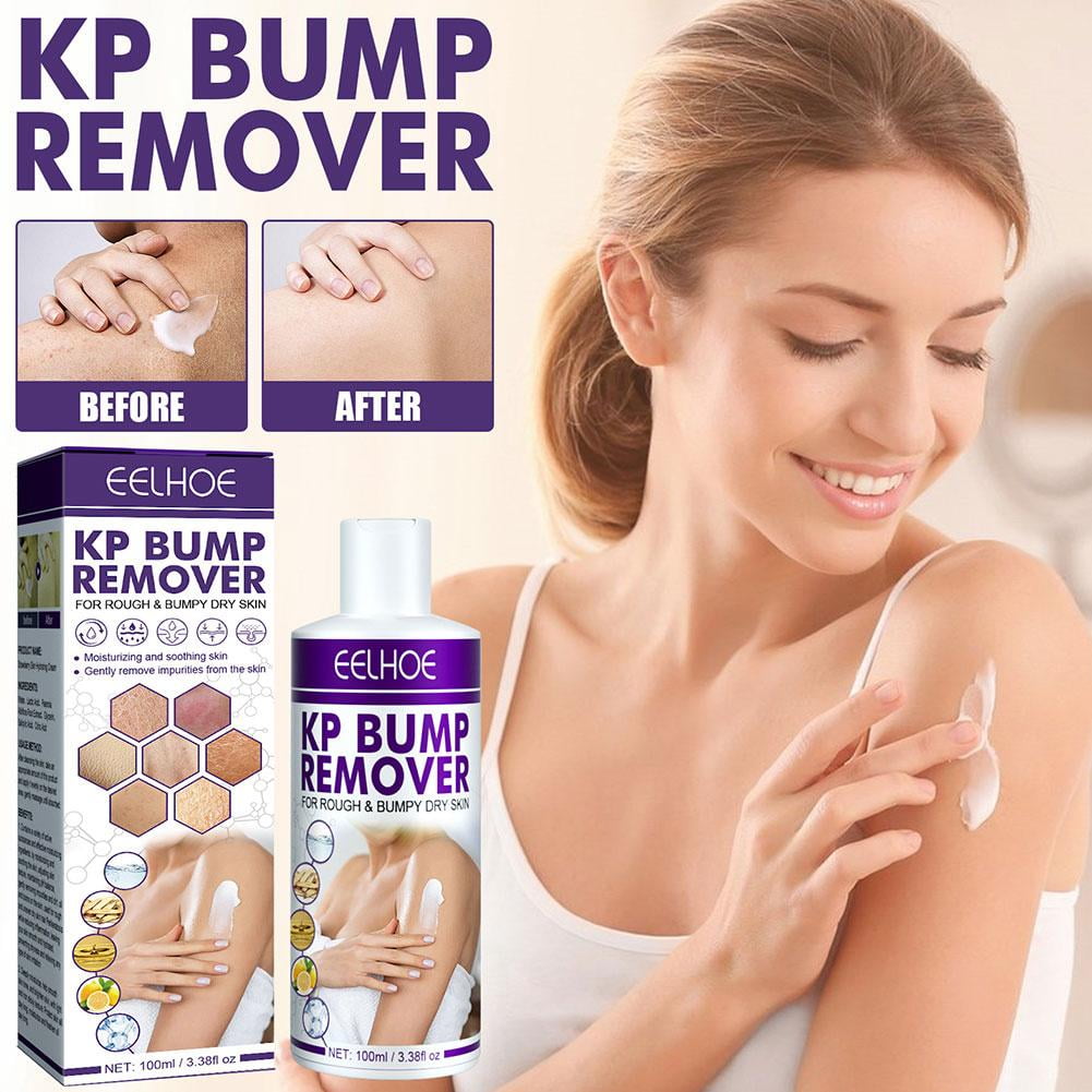 GHYJPAJK 100ml Hair Keratosis Repair Plaster Repairs Skin Flaws, Unevenness And Complaints Deep ...