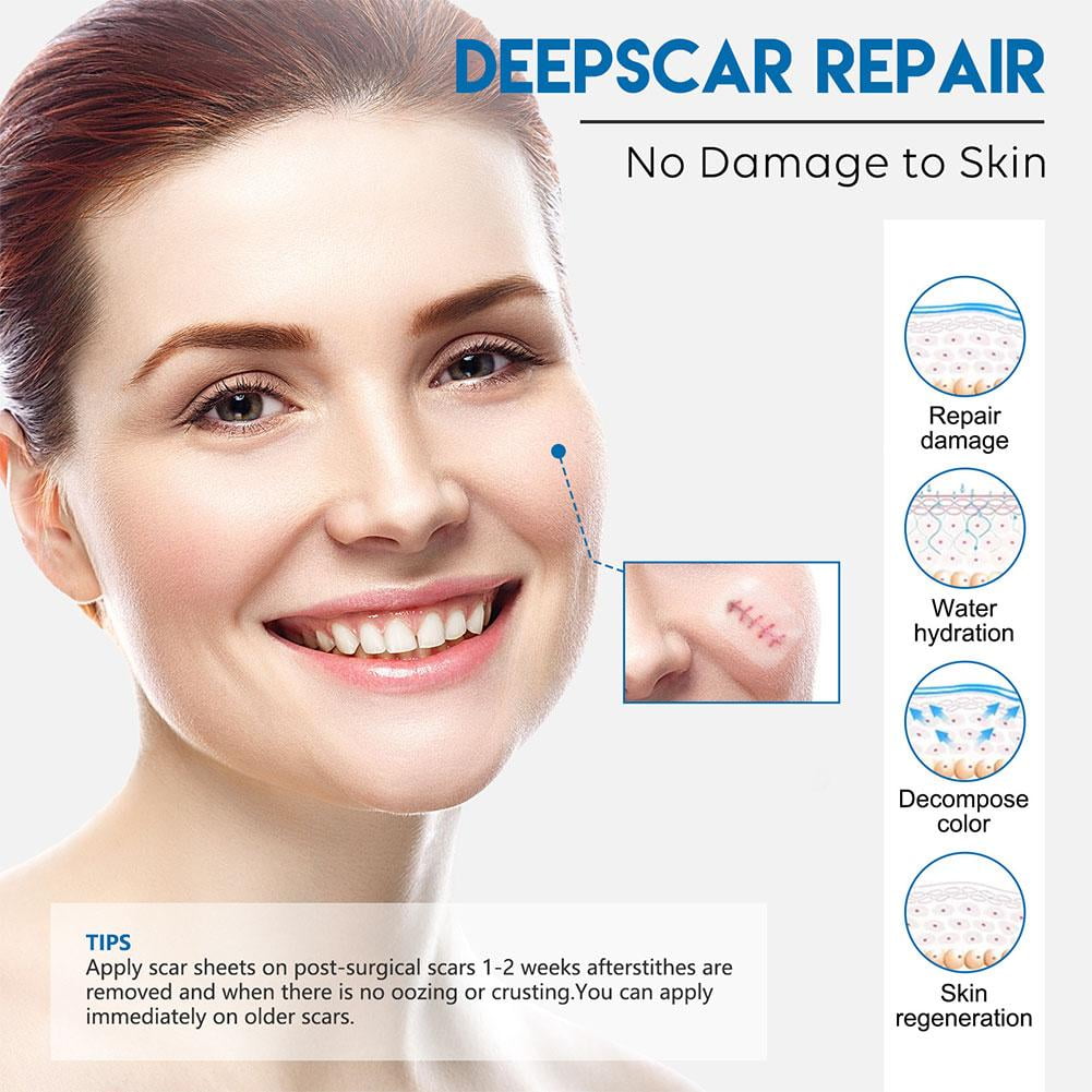 GHYJPAJK 2.5cm * 1.5m Surface Part 隐-Shaped Scratch Mark Tape Self ...