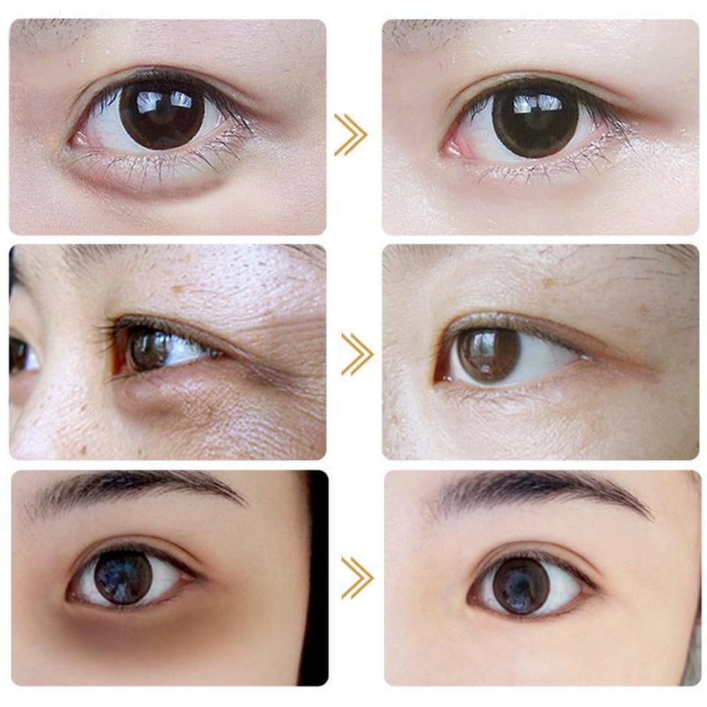 GHYJPAJK 30g Yellow Eye Frosting Black Eye Area Thinning Wrinkled Eye ...