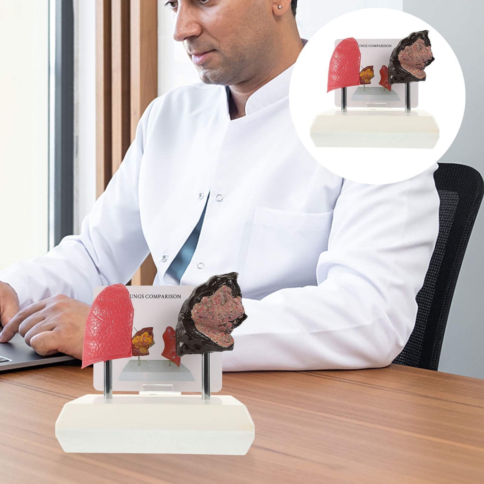 HONMEET Lung Comparison Model For Students Multi PVC 1 Pc - Walmart.com
