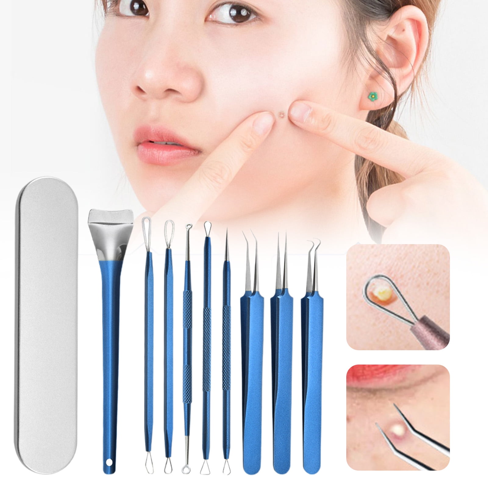 GROFRY 1 Set Blackhead Removal Tool Double-head Sharp Portable Safe ...