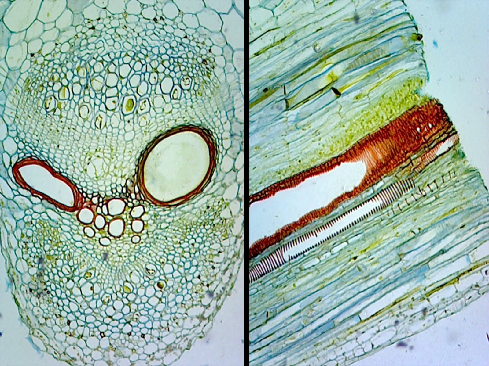 Pumpkin (Cucurbita) Stem; Typical Dicot Stem; Cross Section and ...