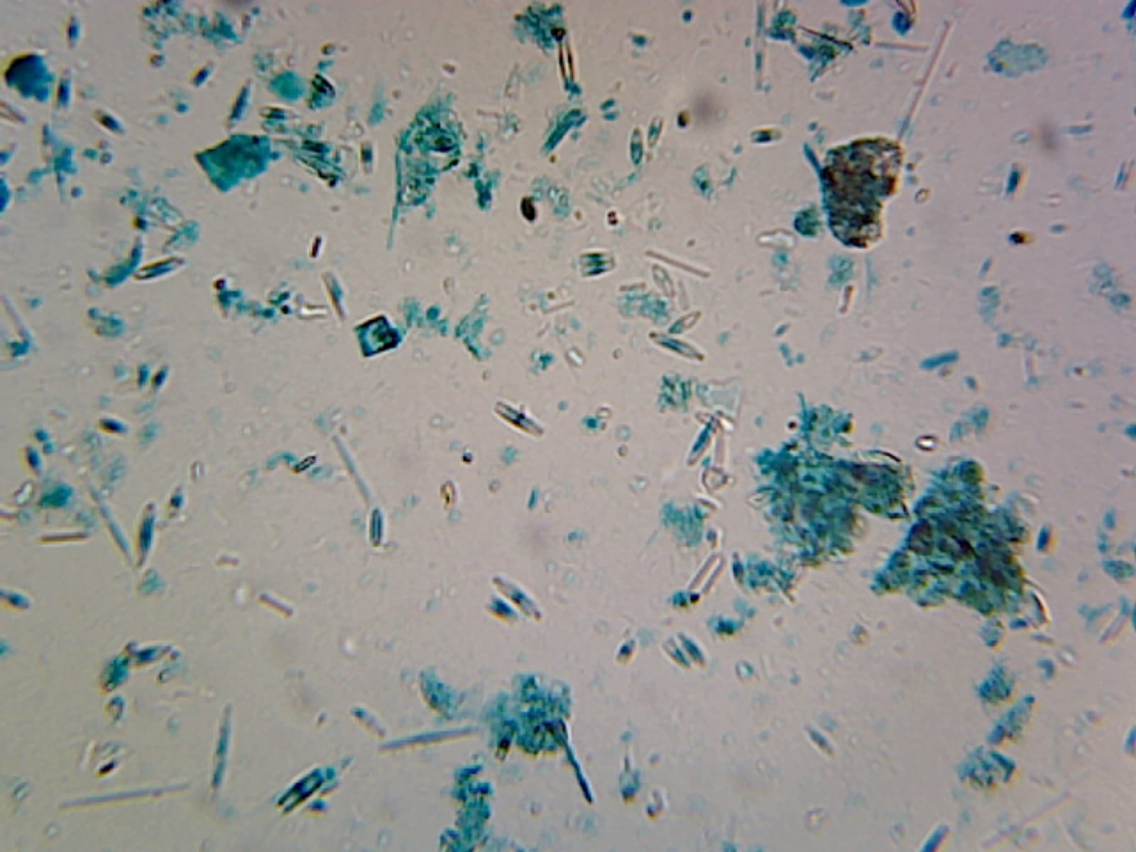 Diatomeae (Comparing Various Mixed Diatoms); Whole-mount by Go Science ...