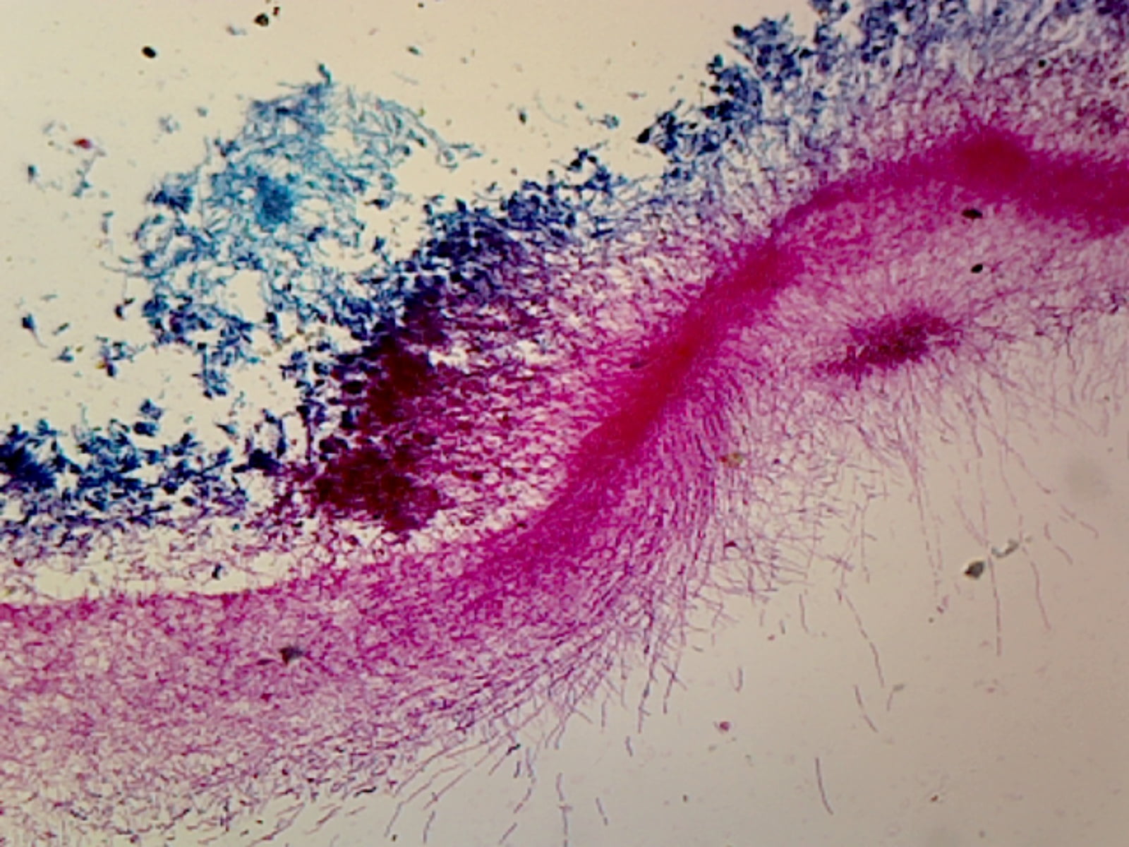 Penicillium; Whole-mount by Go Science Crazy - Walmart.com