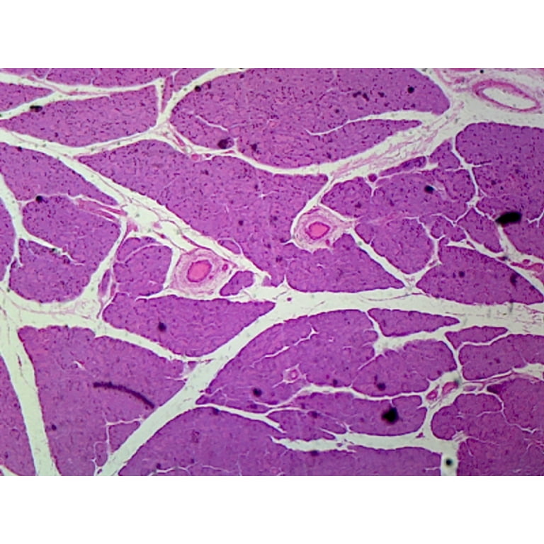 Pancreas Slide Labeled