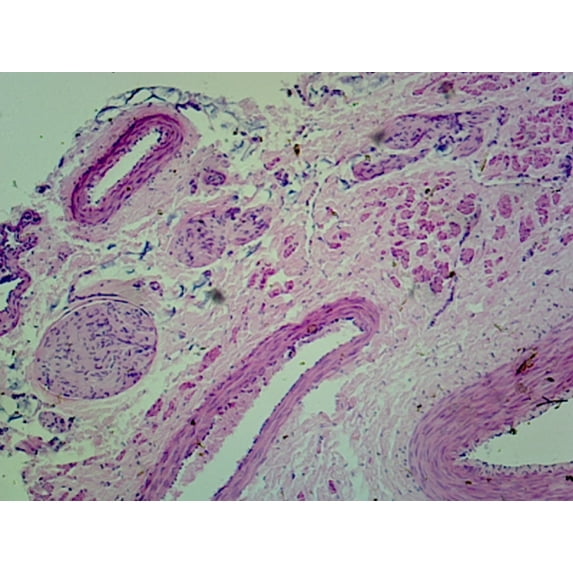 Medium-Sized Artery and Vein, Human; Cross Section by Go Science Crazy ...