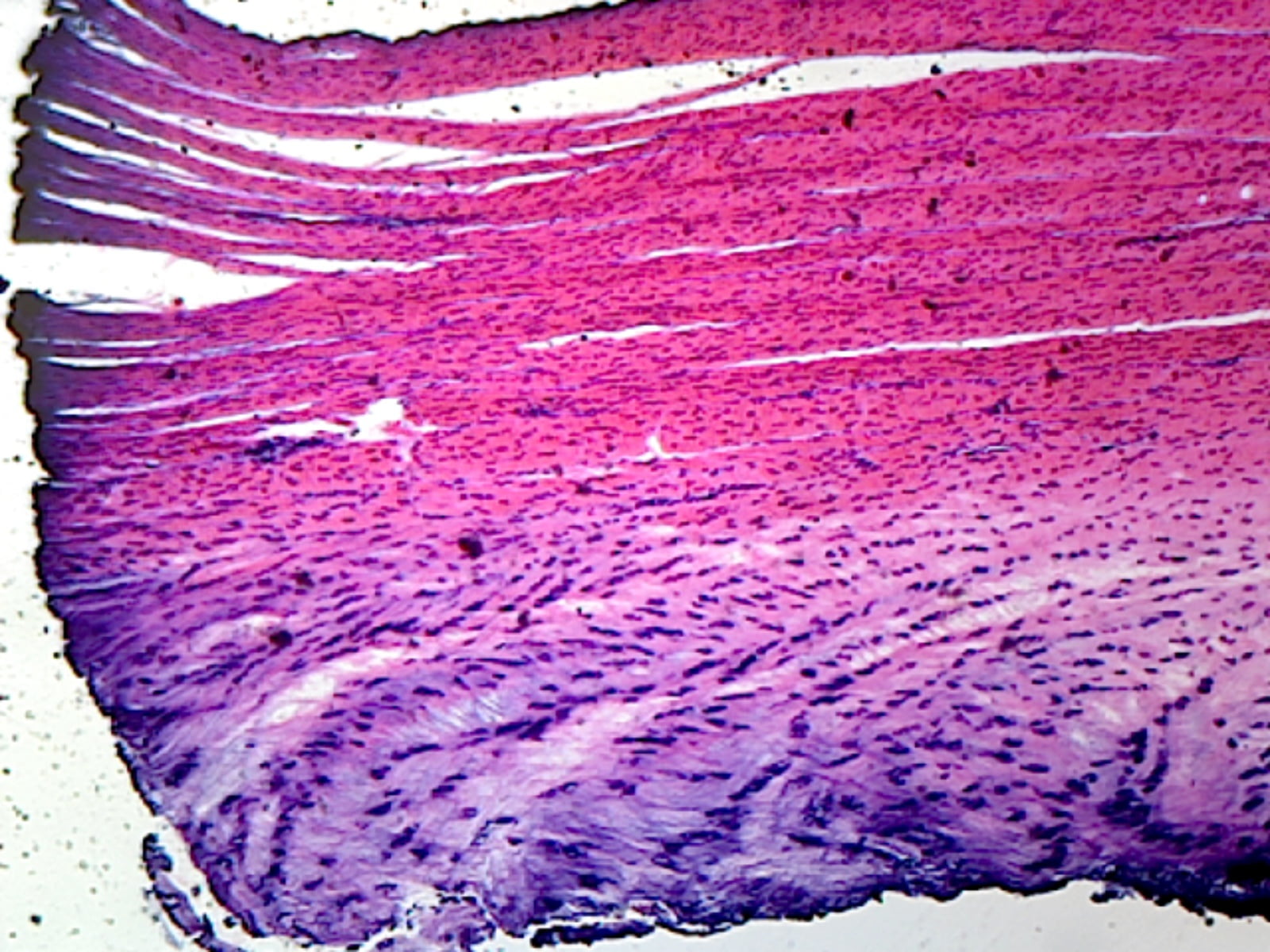 GSC International PS0299 White Fibrocartilage from Intervertebral Disc ... GSC International PS0299 White Fibrocartilage from Intervertebral Disc ...