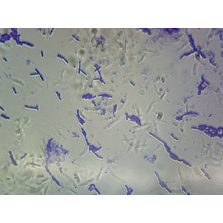 Gram Positive Spore Forming Bacilli