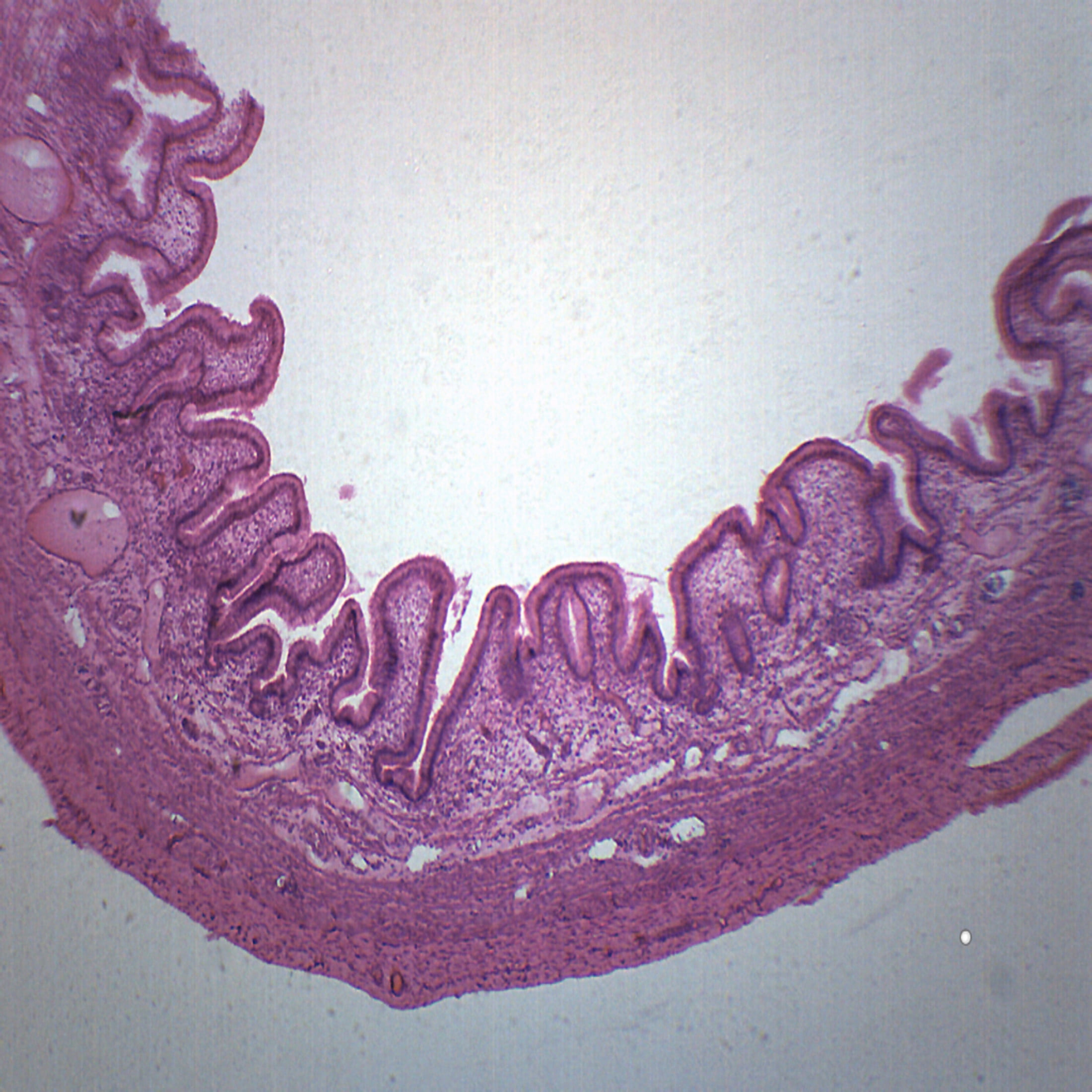 Gallbladder, Cross Section - Prepared Microscope Slide - 75 x 25mm ...