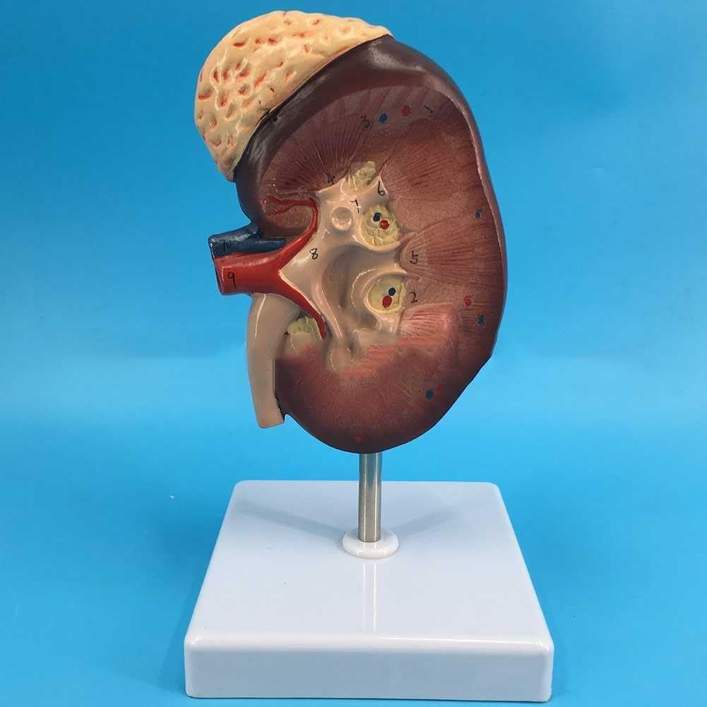 Gamvdout 2X Enlarged Human Kidney Anatomical Model with Accurate ...