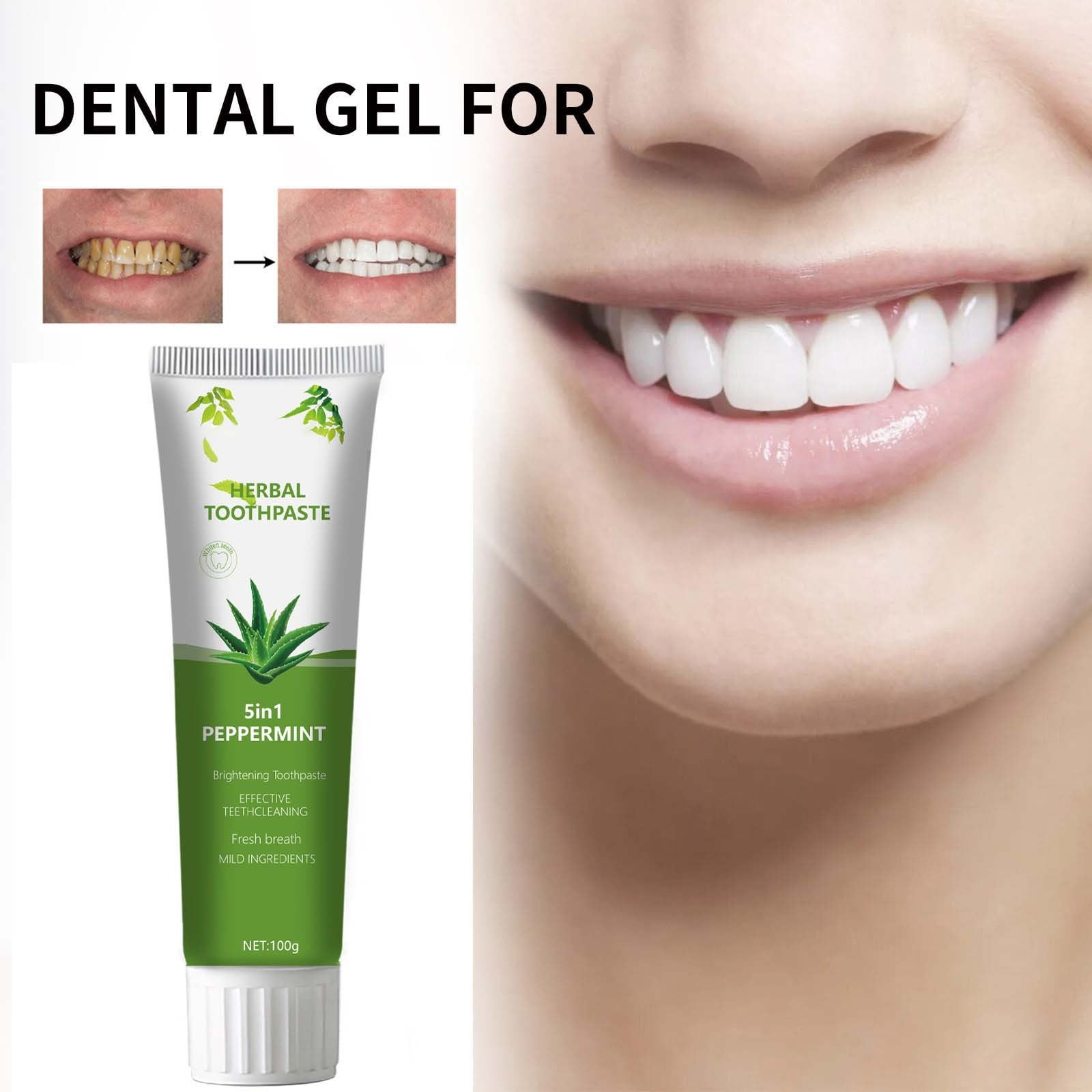 Ganfancp Aloe Toothpaste, Gentle Enamel Safe Recipe, Fresh Breath ...
