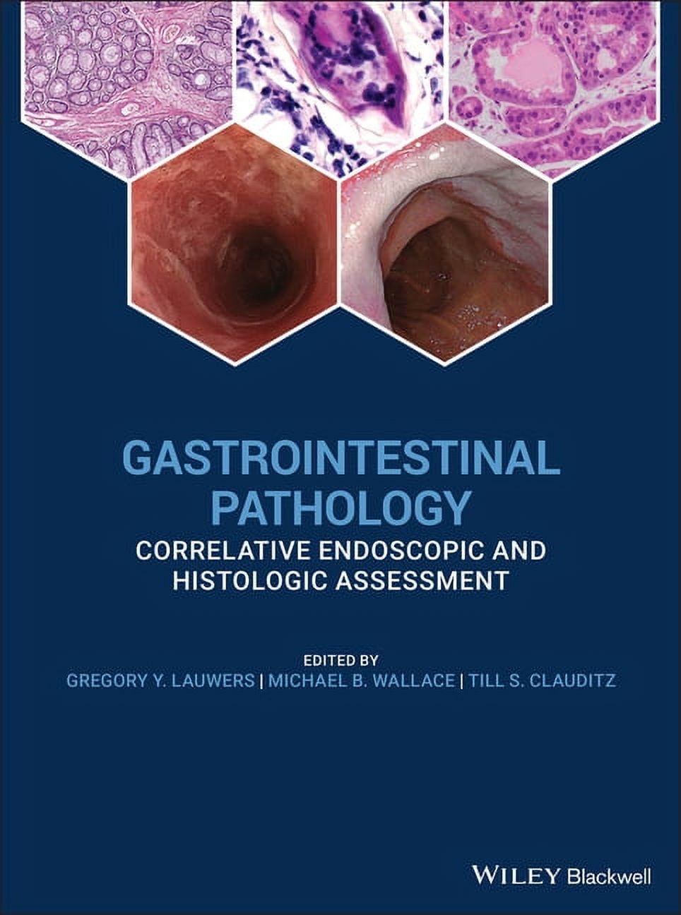 Gastrointestinal Pathology: Correlative Endoscopic and Histologic ...