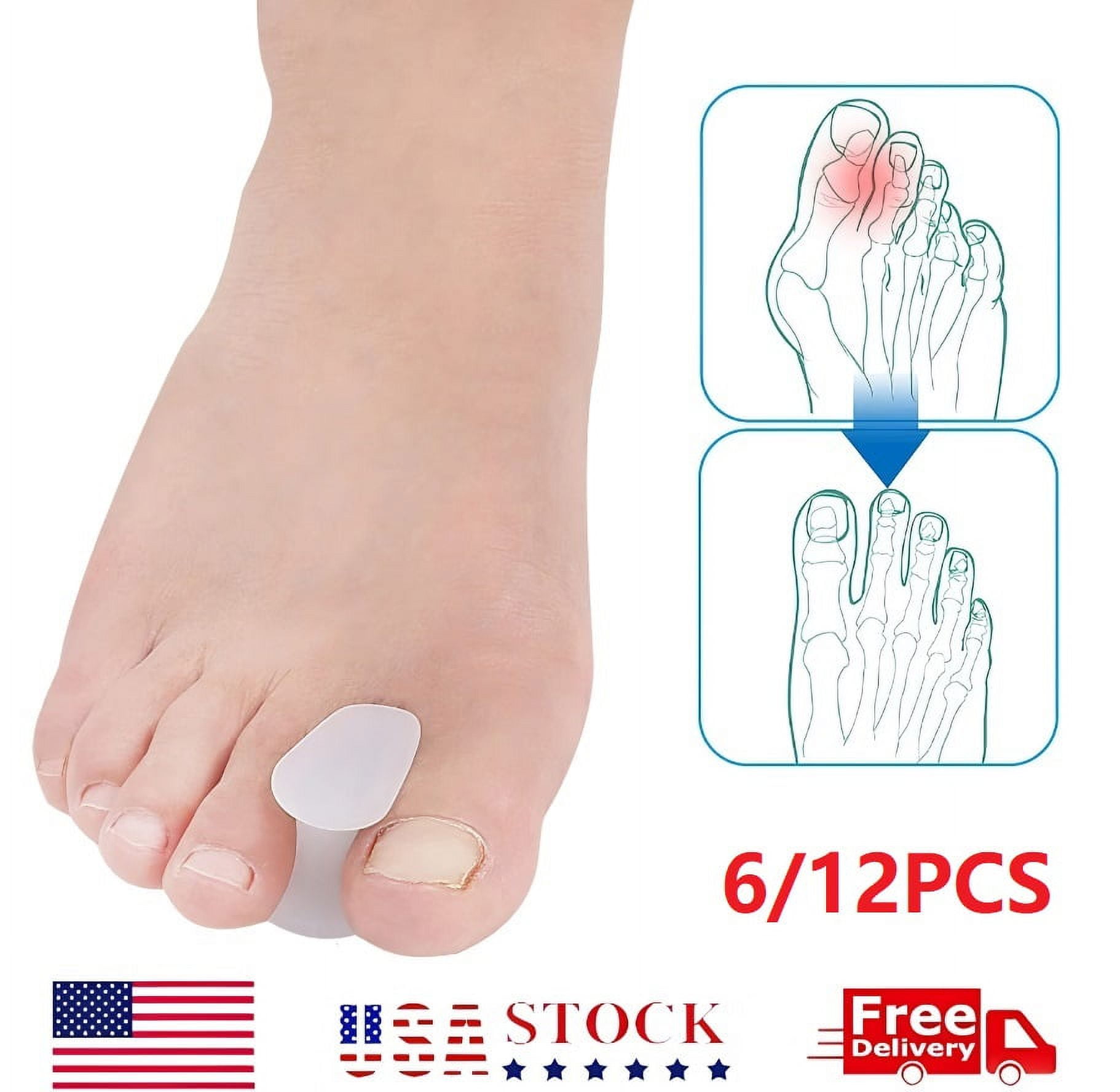 Gel Separators & Bunion Spacers for Toe Alignment – Straighteners ...