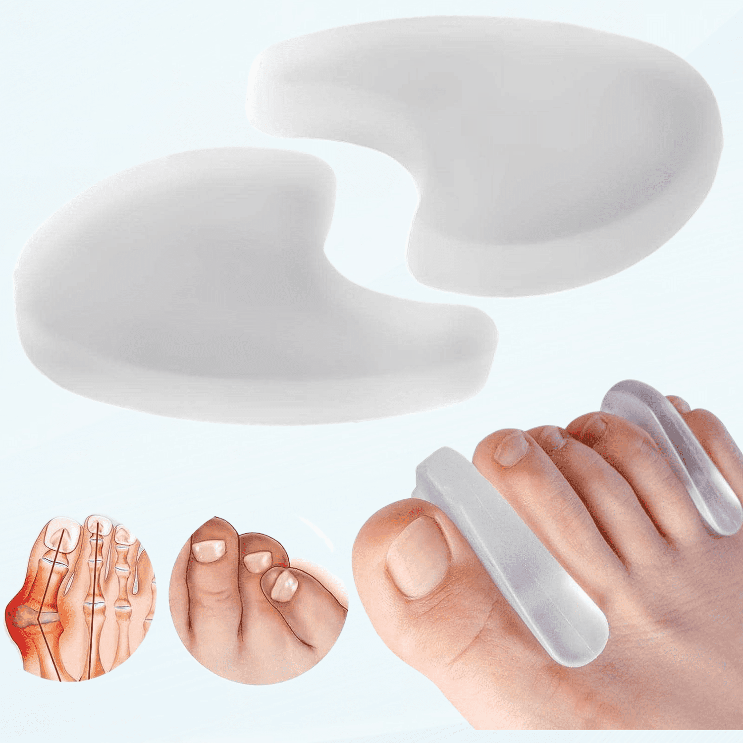 Toe Separators Gel | Correct Bunions, Straighten Toes, and Restore ...