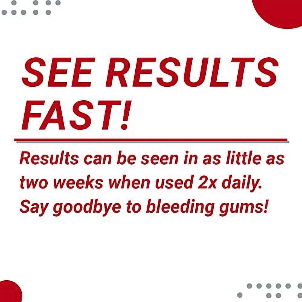 Gel for Trays (5 Tubes + Trays) - 1.7% Hydrogen Peroxide Gel - Designed ...