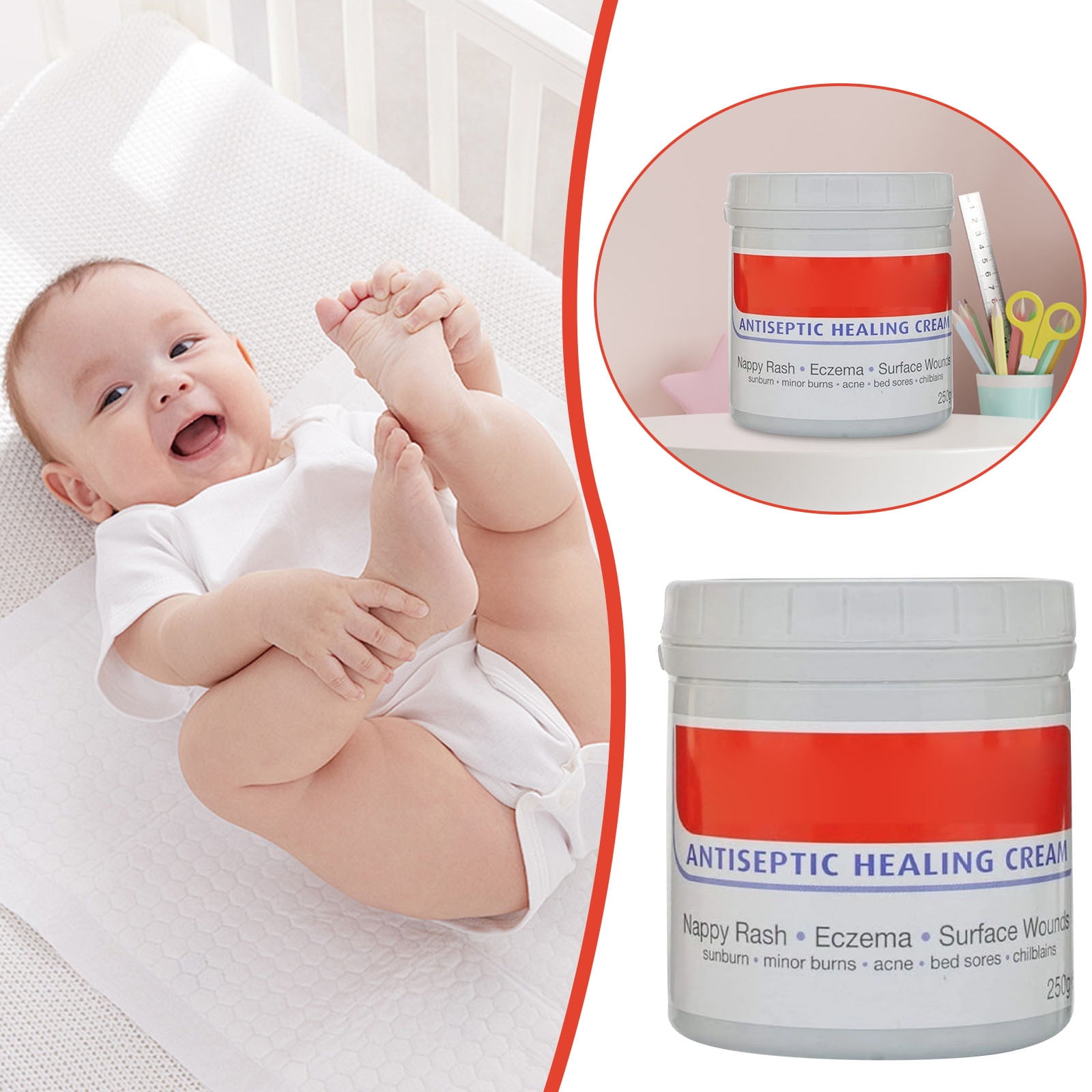 Gentle Skin Protectant Barrier Cream for Kids - 250g of Relief from ...