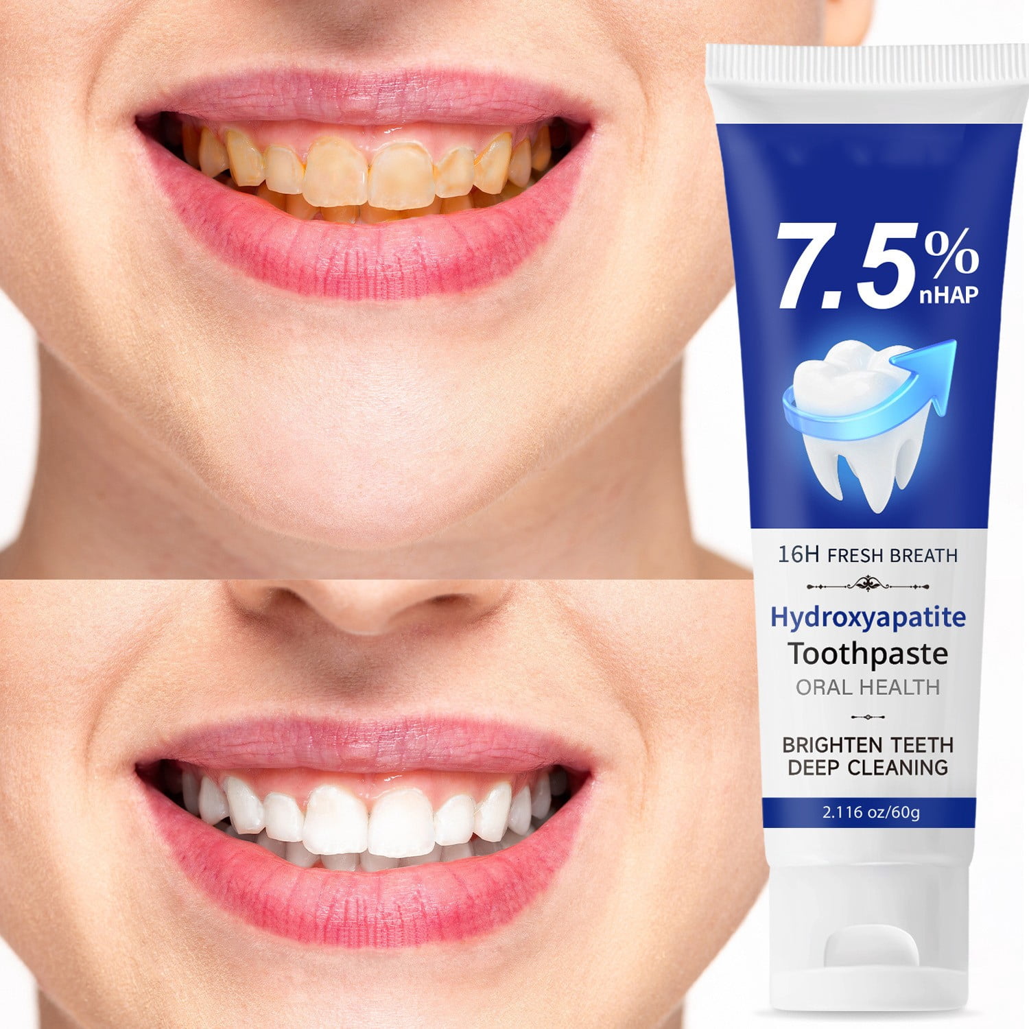 Gentle Teeth Cleaning Toothpaste with Advanced Stain Removal and ...