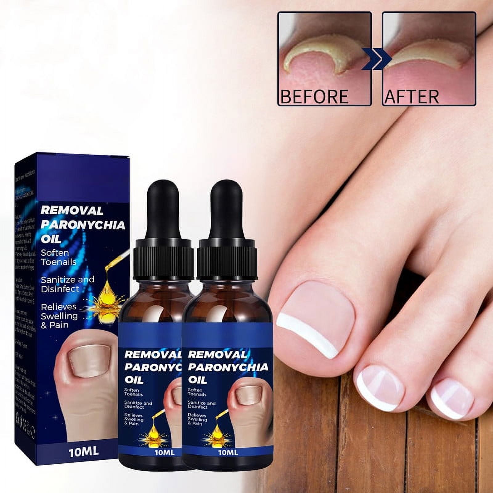 German Toenail Care Paronychia Oil, German Toenail Care oil for ...