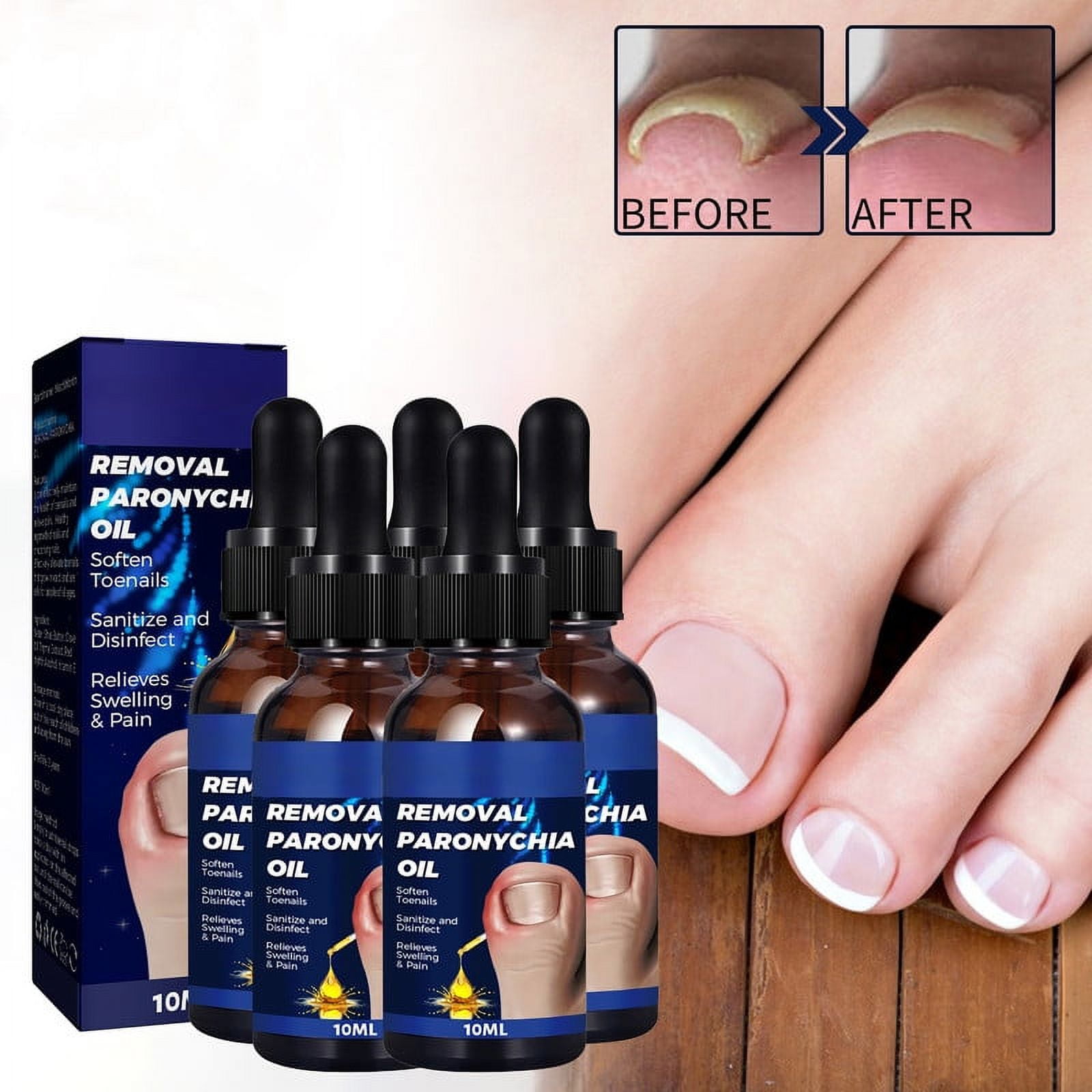 German Toenail Care Paronychia Oil, German Toenail Care oil for ...