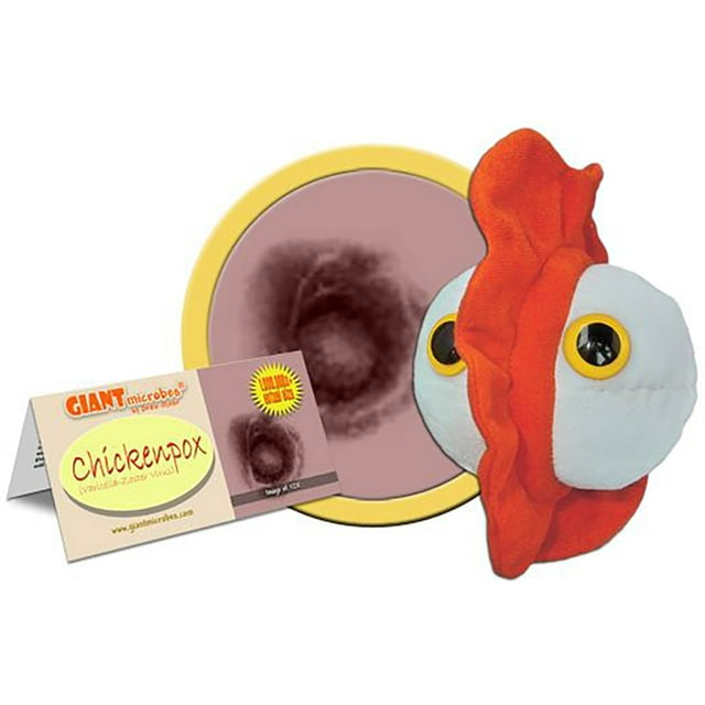 Giant Microbes Plush - Chickenpox (Varicella-Zoster Virus) - Walmart.com