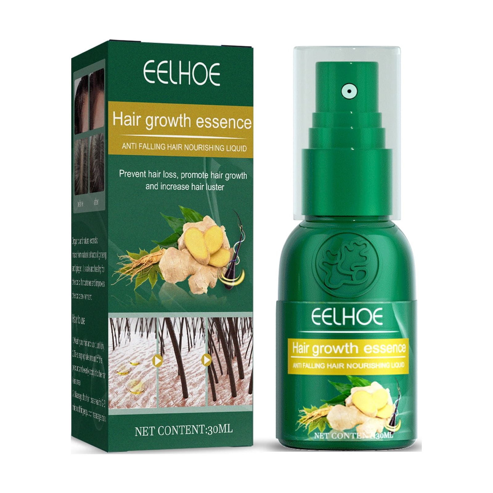 Ginger Hair Growth Spray, Nourishing And Nourishing Hair Root, Hair Care Solution To Prevent ...