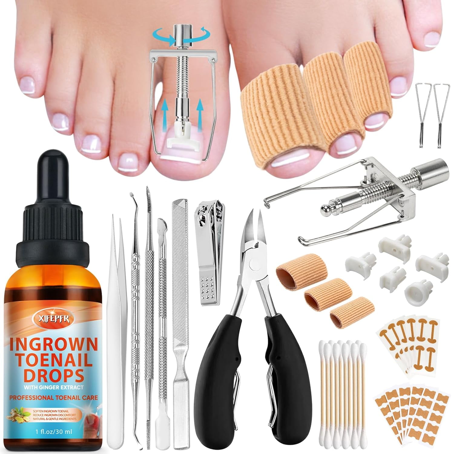 Ginger Ingrown Toenail Treatment, Professional Ingrown Toenail Removal ...