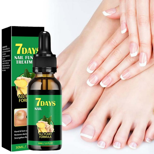 Ginger Nail Repair Liquid - Strengthening Treatment for Hands & Feet ...