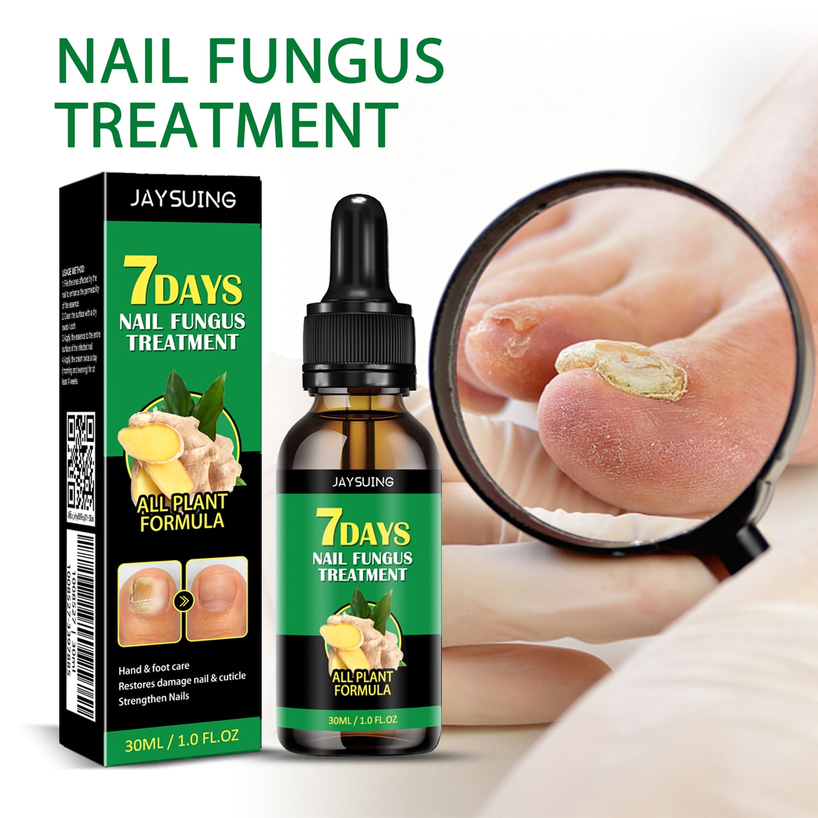 Ginger Nail Treatment Nail Support Nail Care, 7days Nail Fungus ...