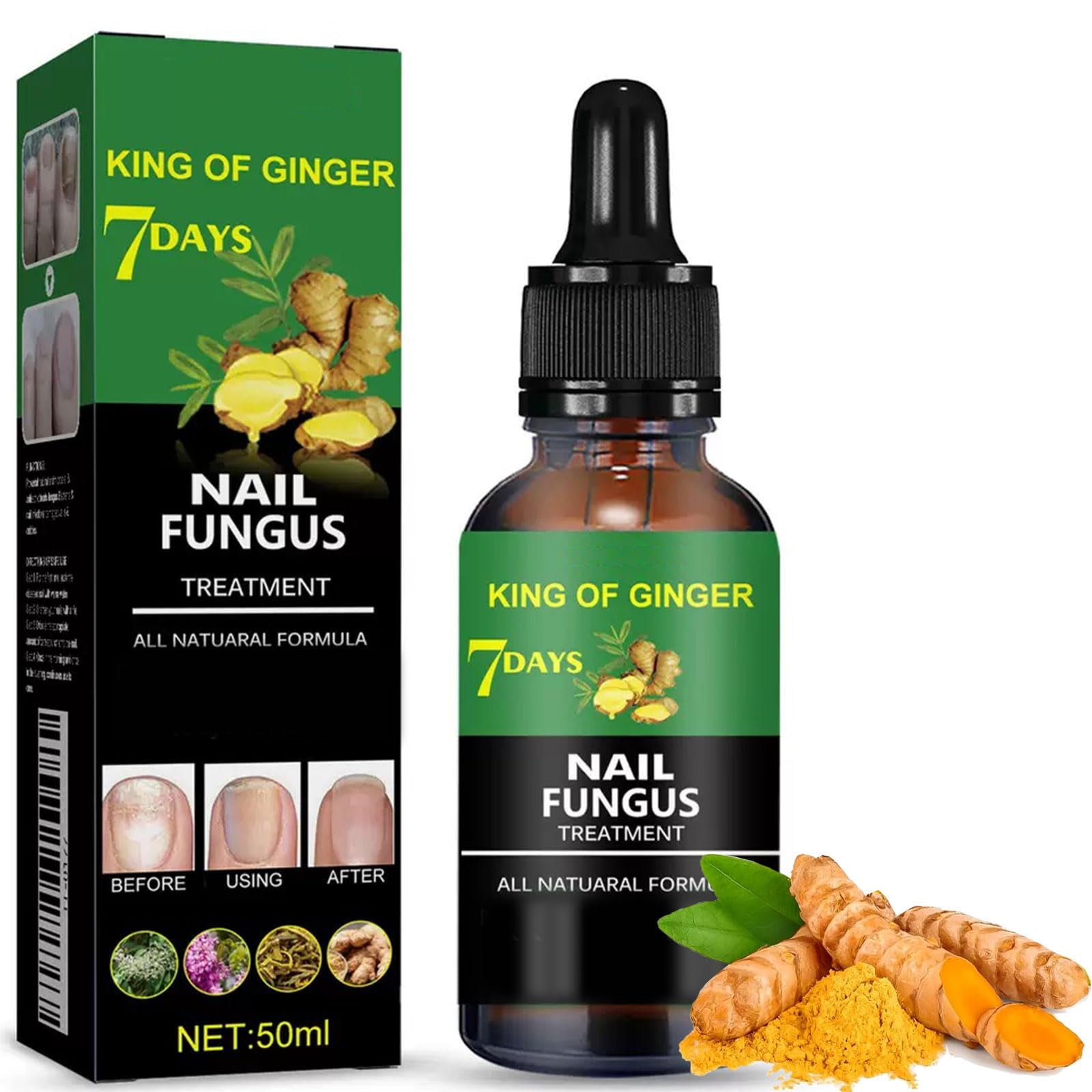Ginger Nail Treatment Serum Oil, Nail Regrowth Serum, Nutrient Oil for ...