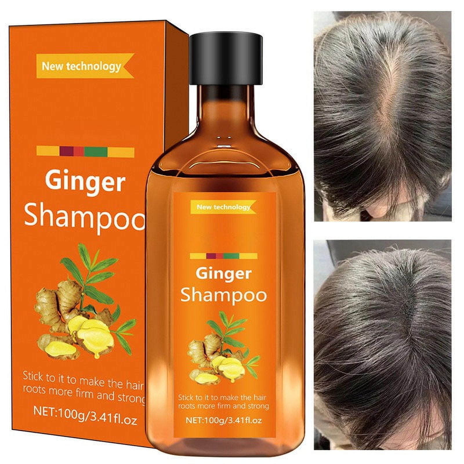 Ginger Shampoo for Dandruff Hair, Anti-Dandruff Treatment - Itchy Dry ...