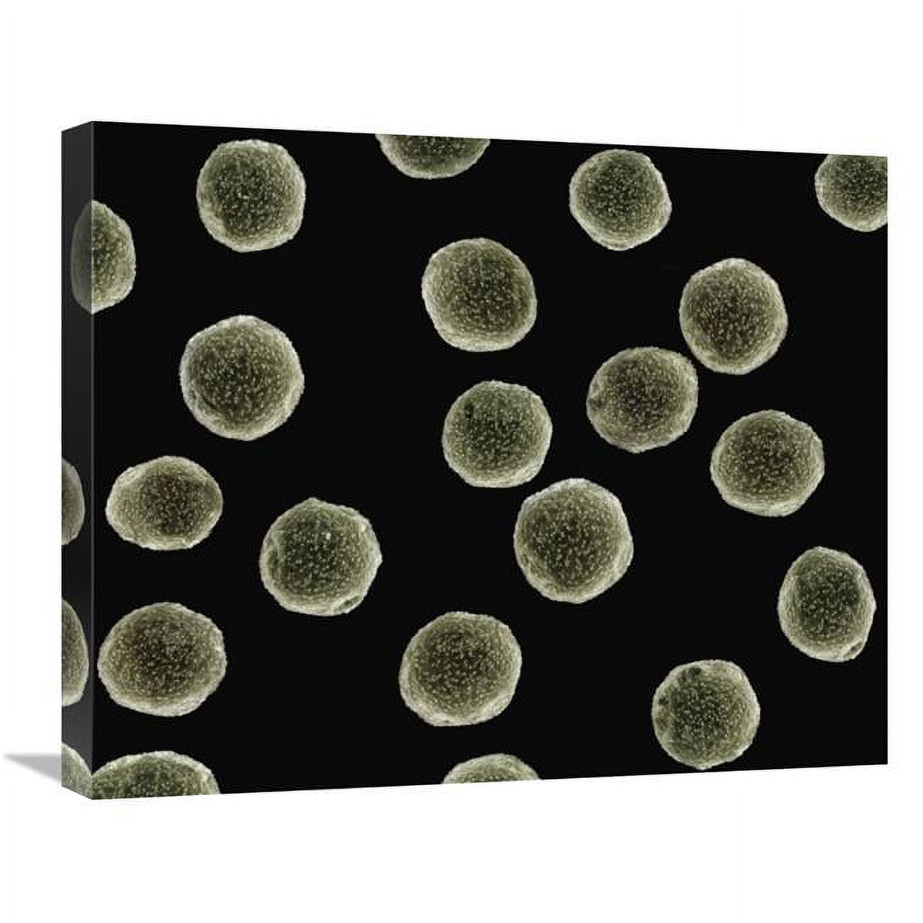Global Gallery 20 x 24 in. Pollen Grains of A Pellitory at 1050X ...