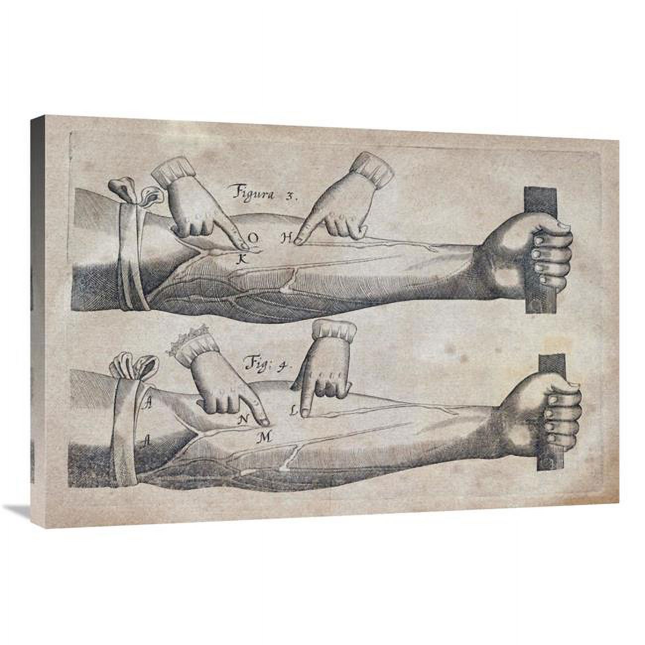Global Gallery Discovery of the Circulation of Blood Art Print ...